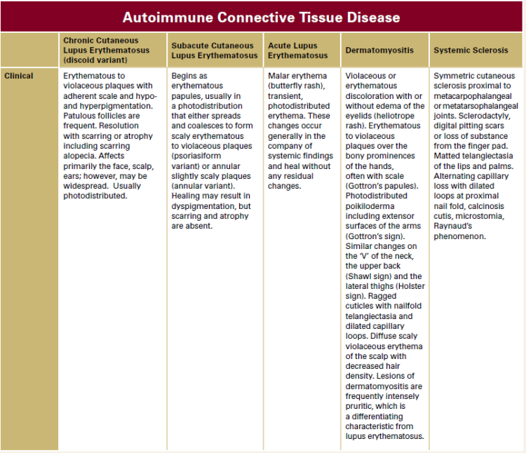 Connective Tissue Diseases