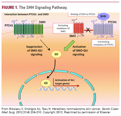 Understanding BCC Pathogenesis: Treatment Advancements and Challenges ...