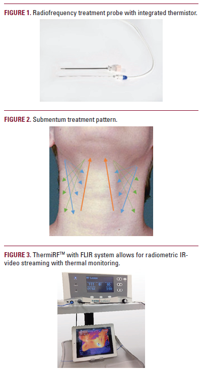 Integration of Thermal Imaging With Subsurface Radiofrequency ...